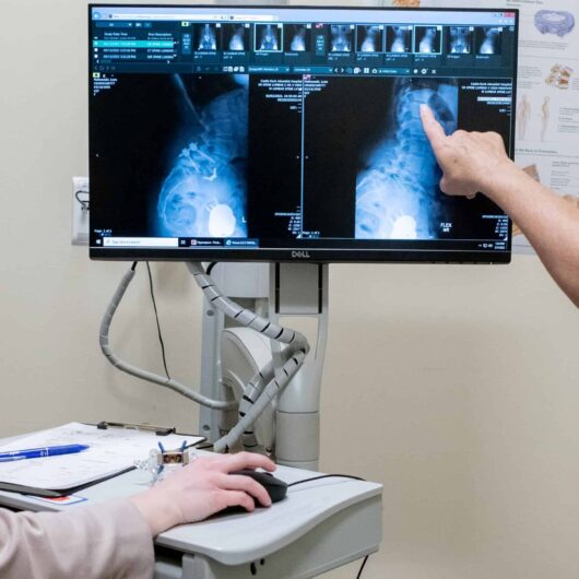 What is the recovery time for neck surgery?