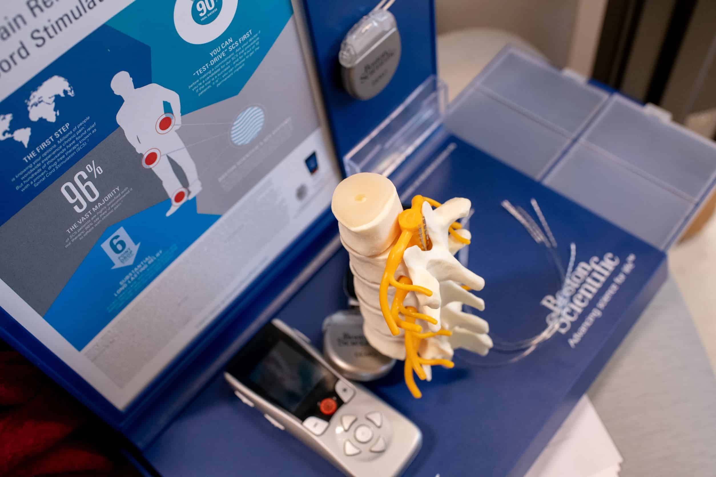 Spinal Cord Stimulation Cuts Pain of Diabetic Neuropathy